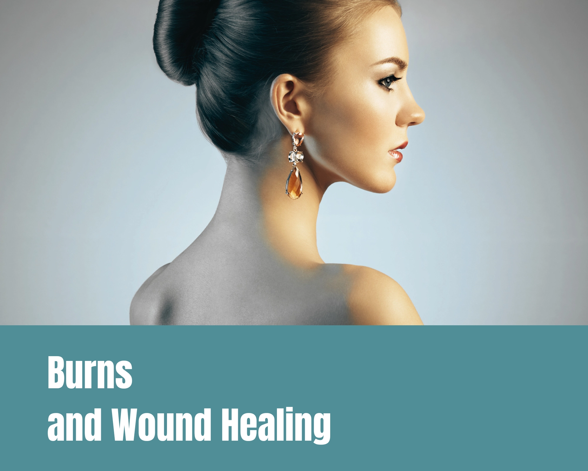Advanced Burns and Wound Healing with Stem Cells