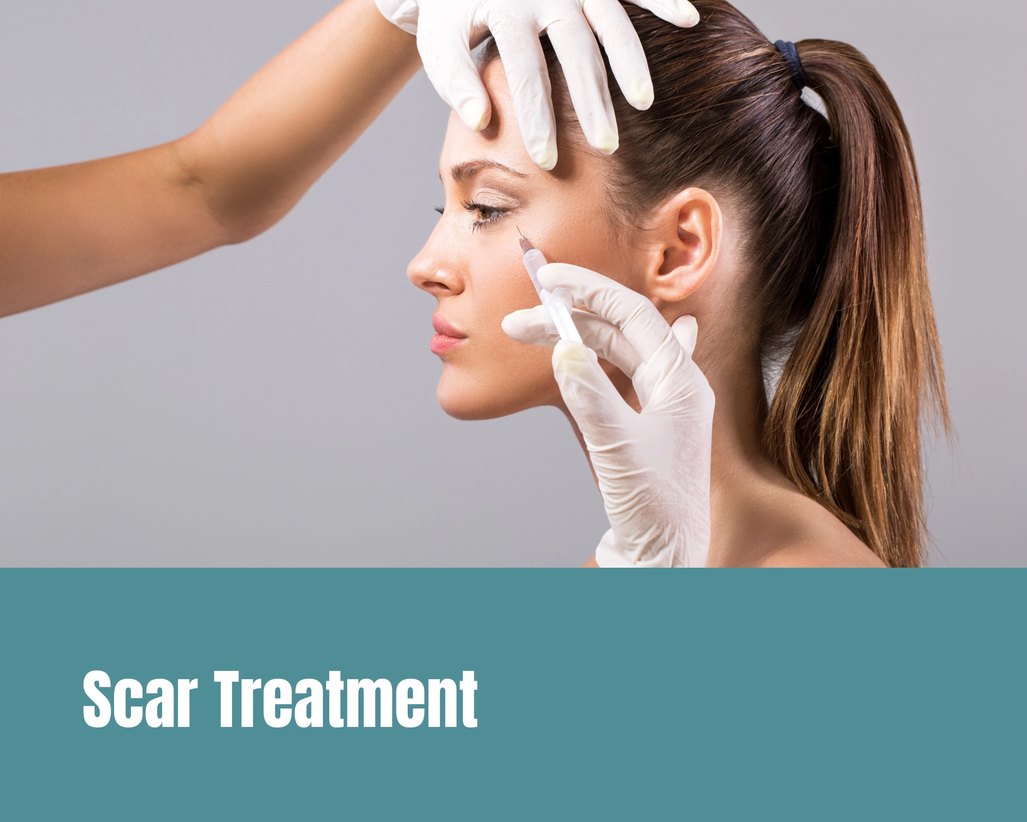 Effective Scar Treatment with Stem Cells